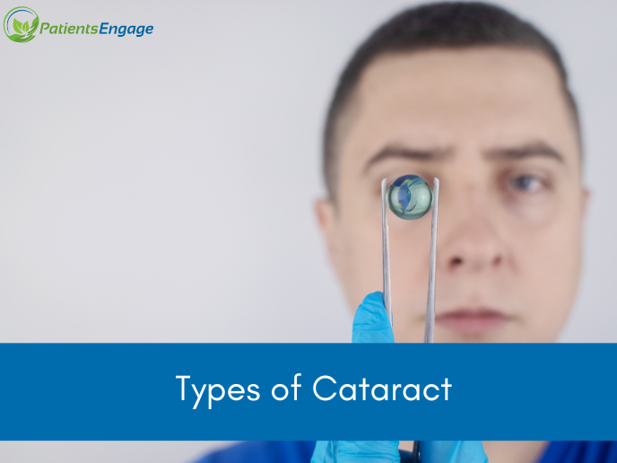Types of Cataract | PatientsEngage